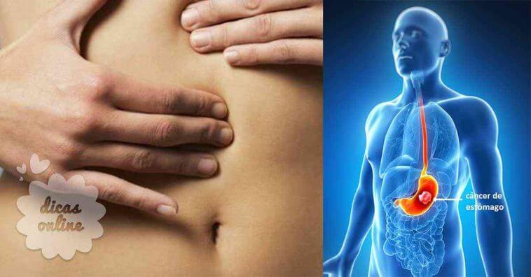 Cáncer de estómago: ¡Conozca sus síntomas y vigile su cuerpo!