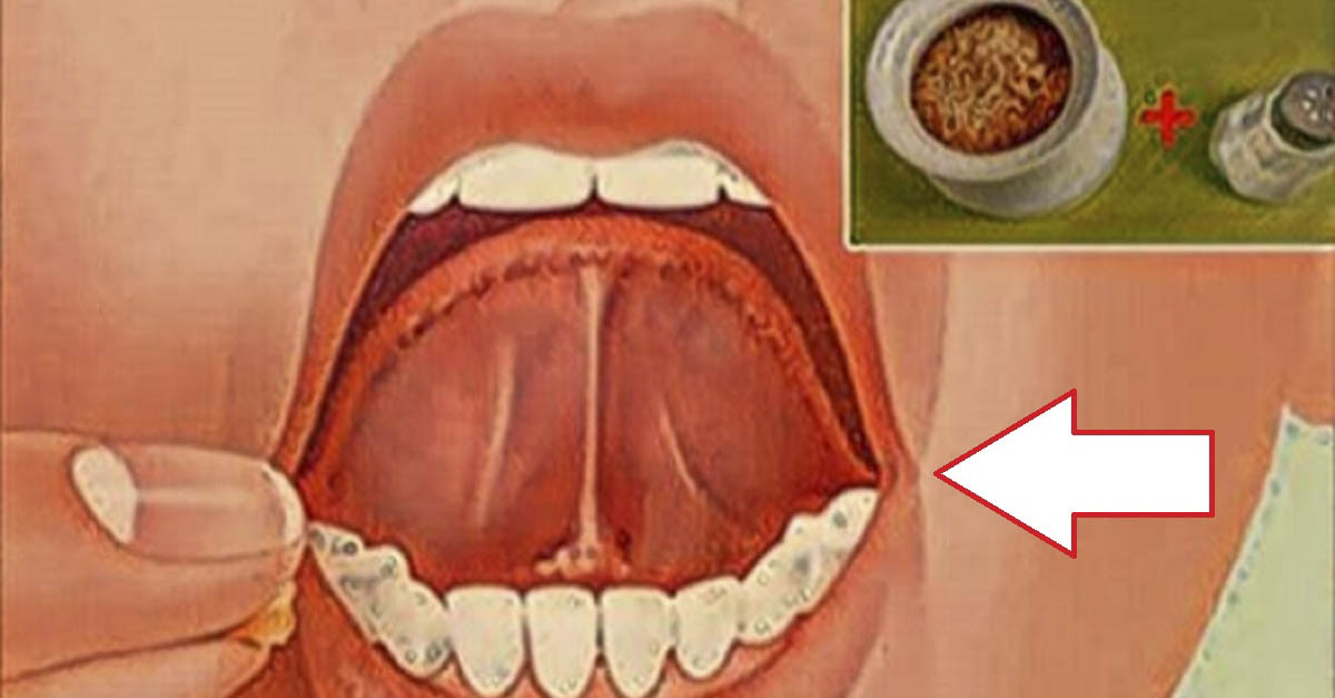 Sal y azúcar: ¡Dos ingredientes que pueden cambiar su vida!