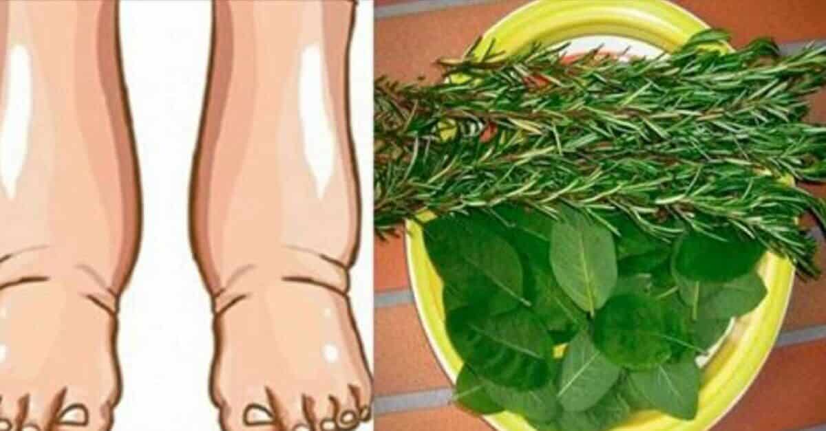 Descubra 6 formas naturales para aliviar la hinchazón en los pies y las ...