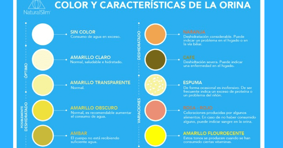 Atención: el color de la orina puede indicar problemas de salud