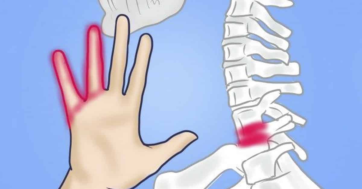 ¿Se entumecen sus extremidades? No ignore estos síntomas