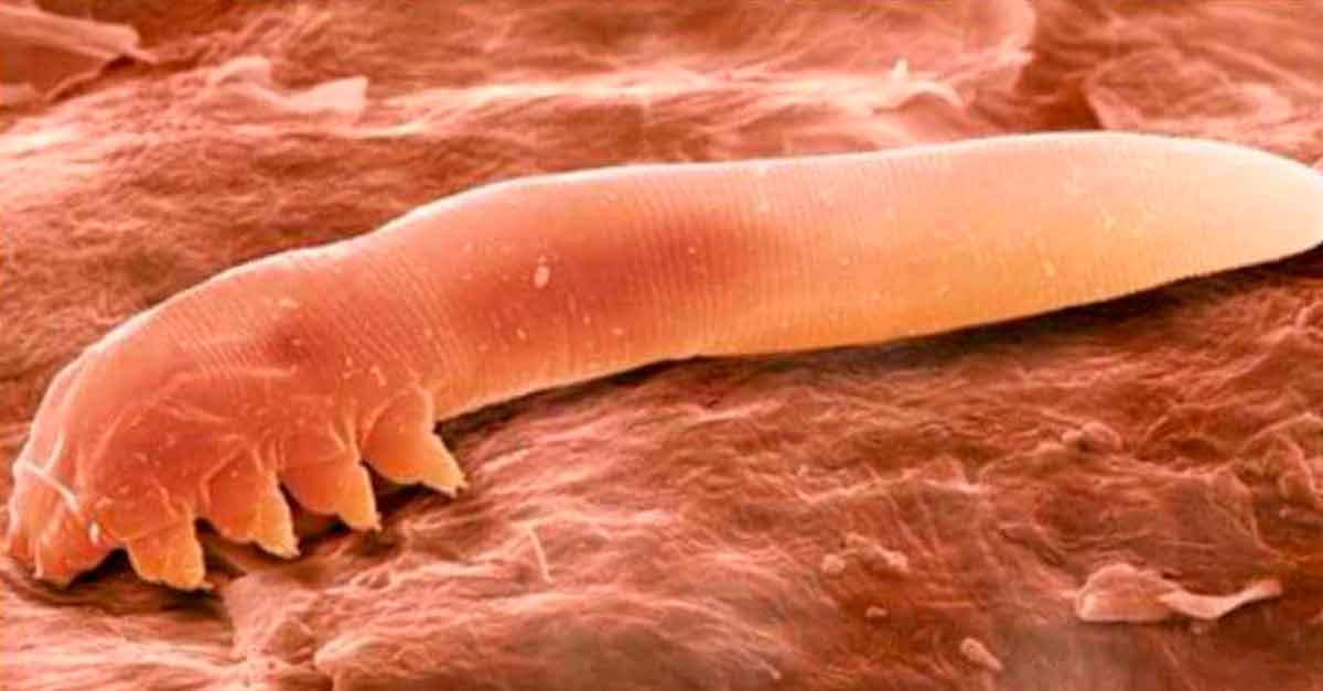 Microorganismo que vive en la cara del ser humano acumula toxinas