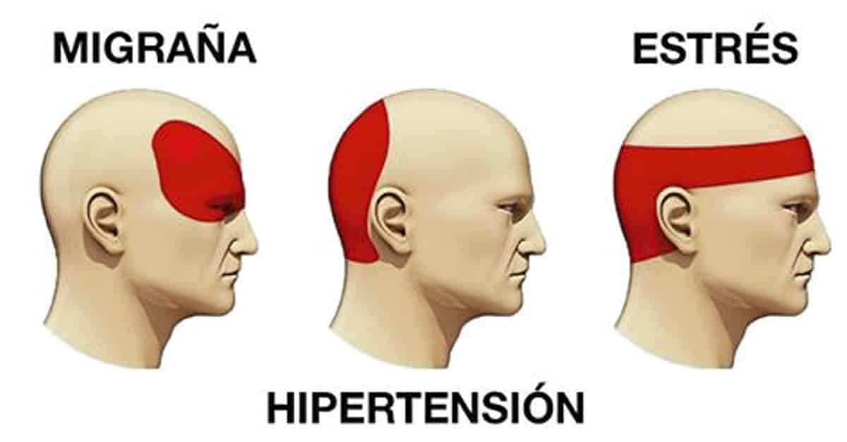 ¿Qué delata cada tipo de dolor de cabeza?