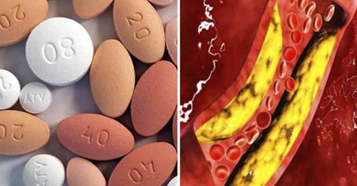 Baje el colesterol sin estatinas con estos 8 consejos