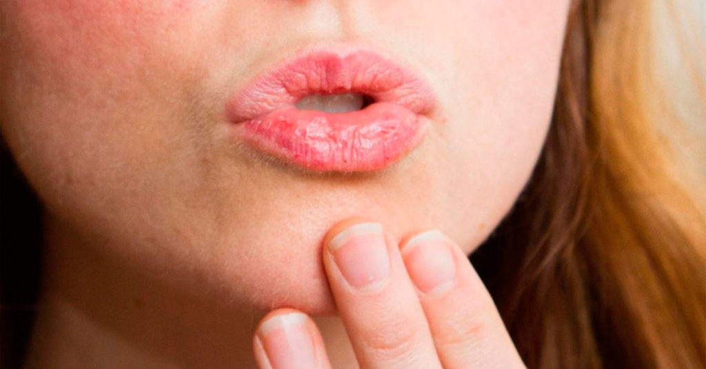 Hidrate sus labios con estos 4 ingredientes naturales
