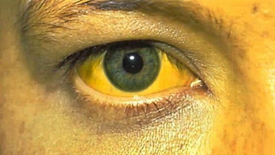Logre identificar estas 10 señales en su rostro y sepa mucho más sobre ...