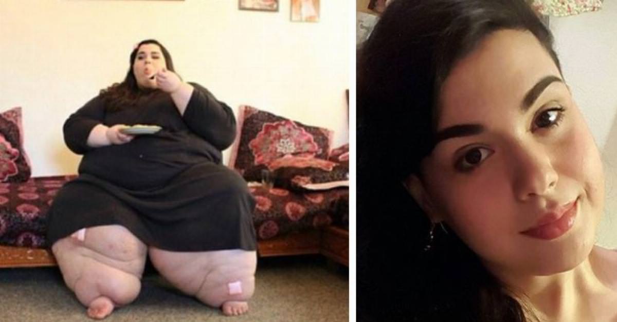 Pesaba 298 kilos... Y ahora, ha adelgazado más de 150