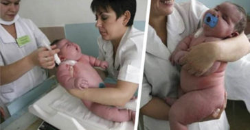 ¡Nuevo record! nació el bebé más grande del mundo en Australia ¡Pesa 18 kg!