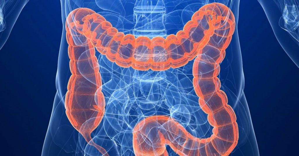 Limpie su colon de forma natural con sólo 4 ingredientes