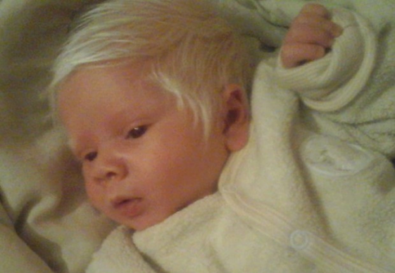 Bebé nació con el cabello totalmente blanco