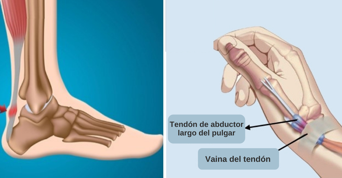 Receta a base de sésamo que ayuda a regenerar los tendones