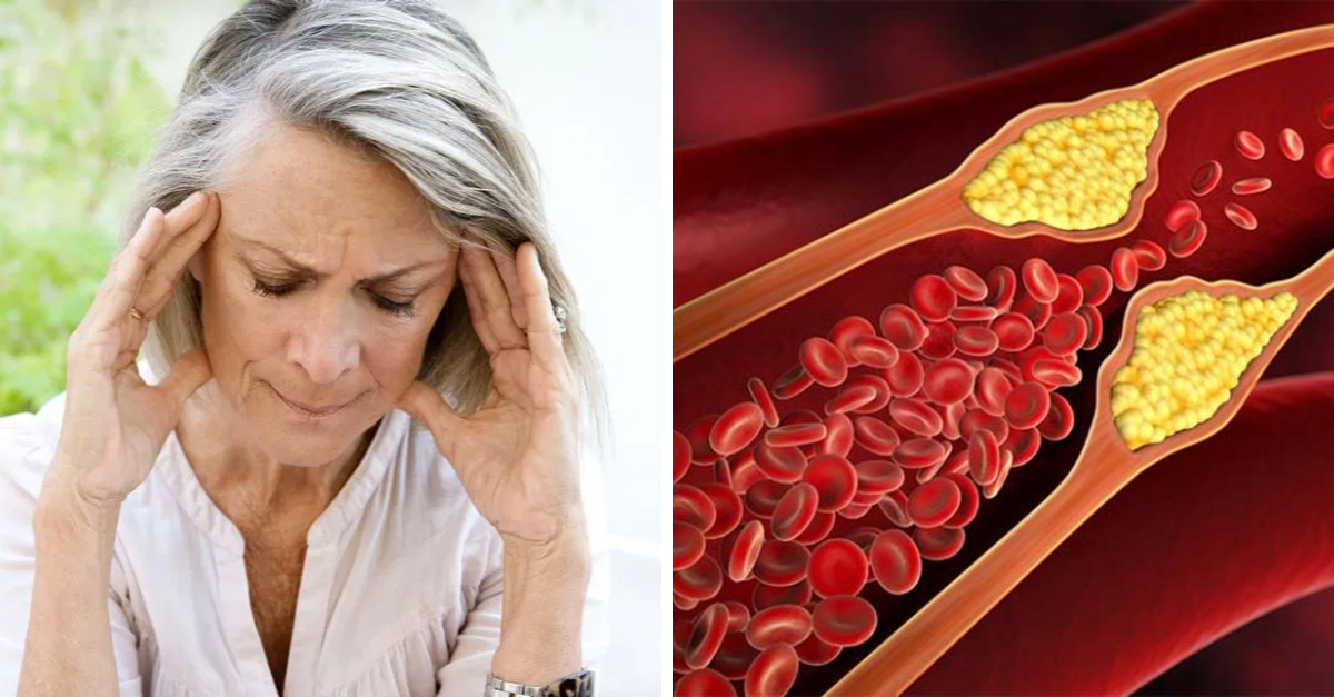 Isquemia: qué es y síntomas