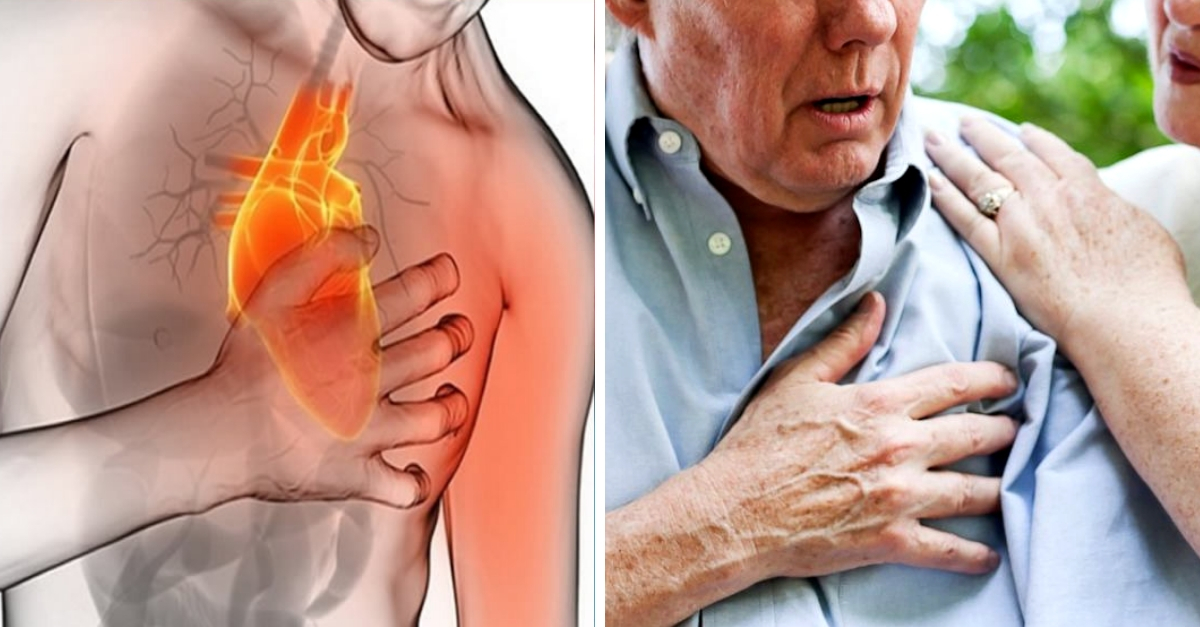 10 Síntomas de un infarto silencioso: sé consciente de a qué le debes ...