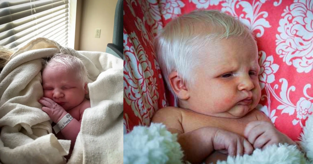 Bebé nació con el cabello totalmente blanco