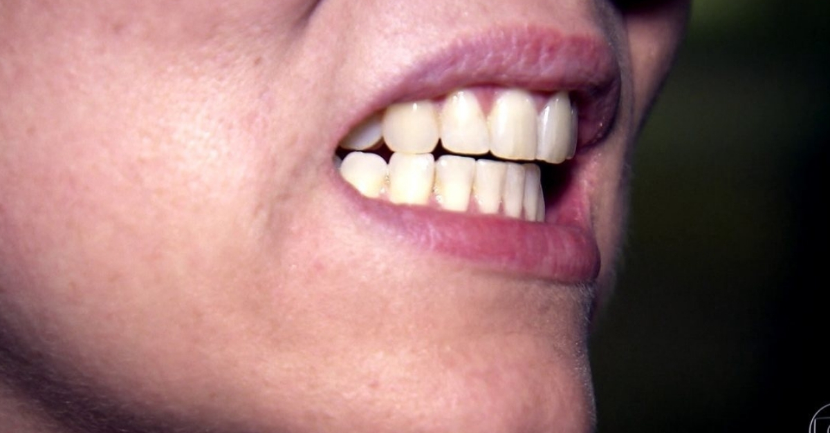 Bruxismo: la enfermedad que hace chirriar los dientes