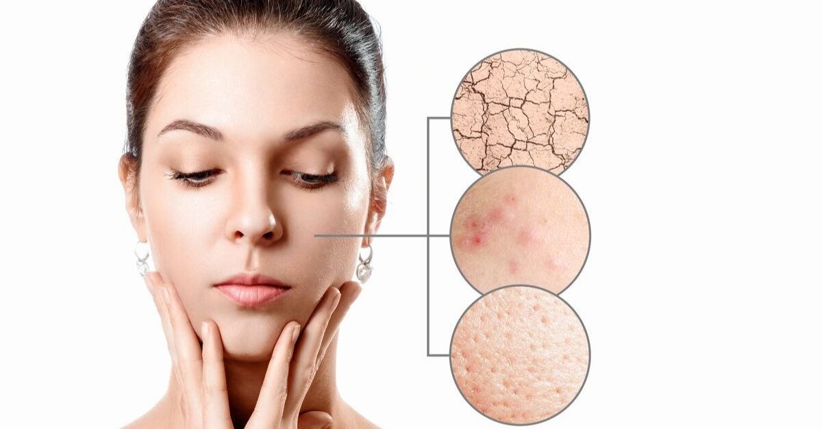 Espinilla interna: cómo extraerla y qué hacer para evitarla