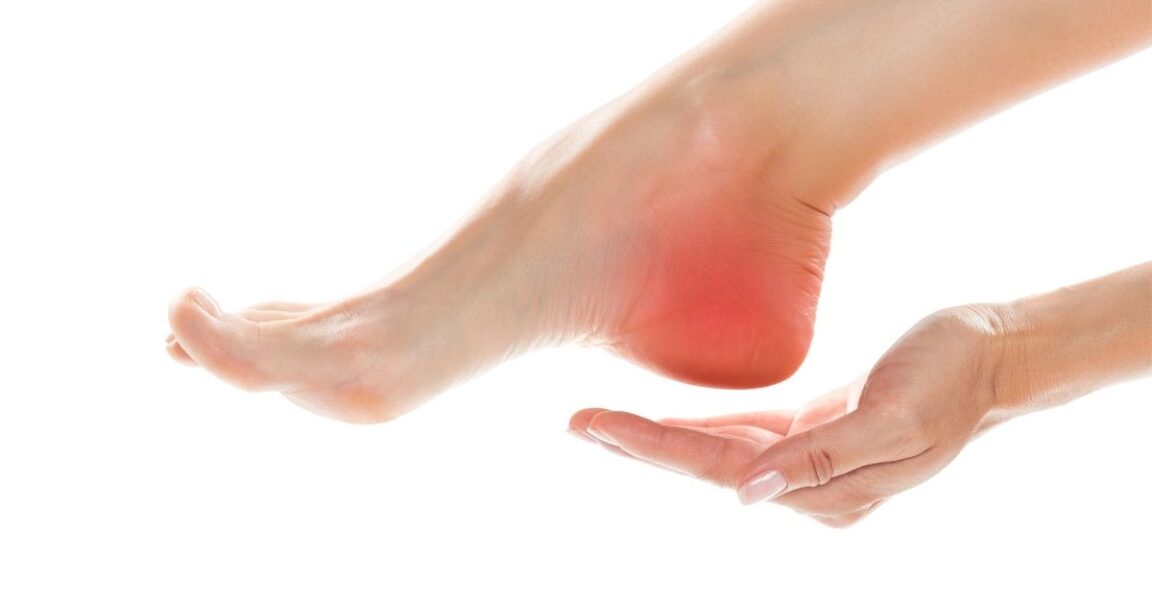 Dolor en el talón: conoce a qué se puede deber y cómo aliviarlo