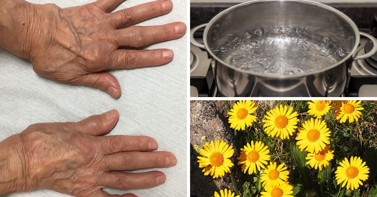 Té de árnica: beneficios y cómo prepararlo