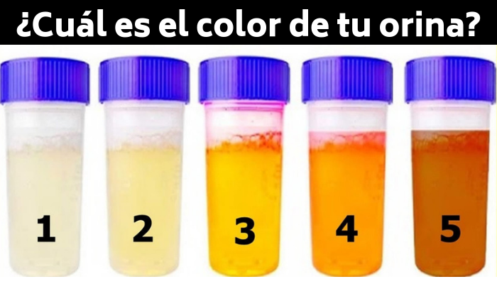Atención: el color de la orina puede indicar problemas de salud