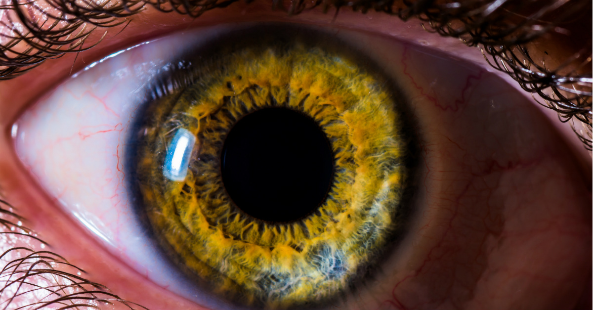 Desprendimiento de retina: qué es, síntomas y causas