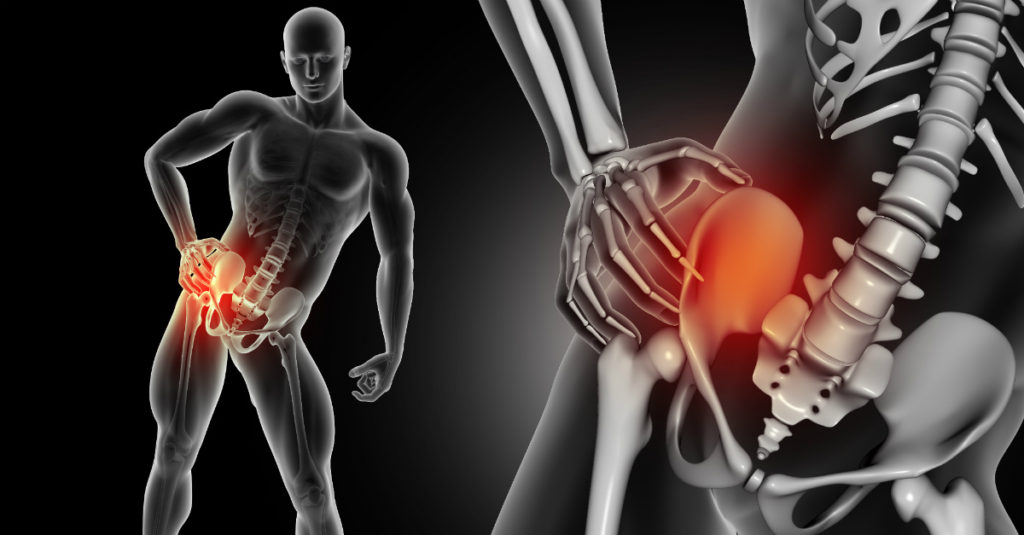 Dolor de cadera: causas y tratamientos