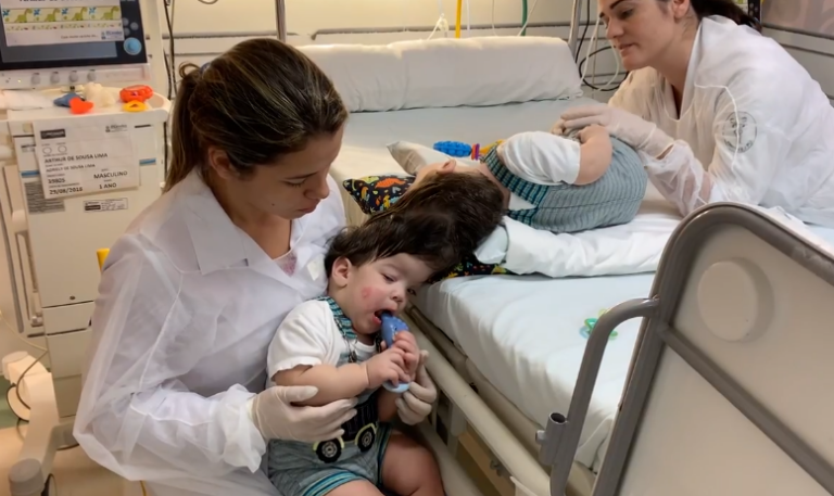 Los gemelos unidos por el cráneo fueron separados en la cirugía