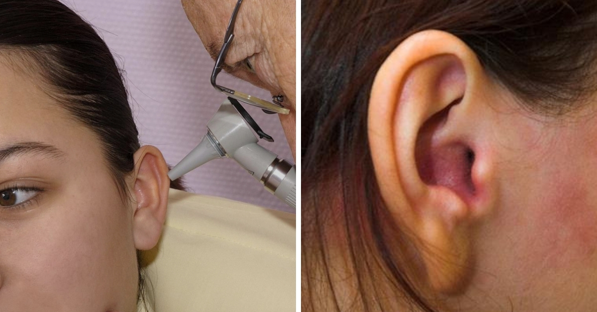 Otitis: sácate todas las dudas sobre esta inflamación en el oído