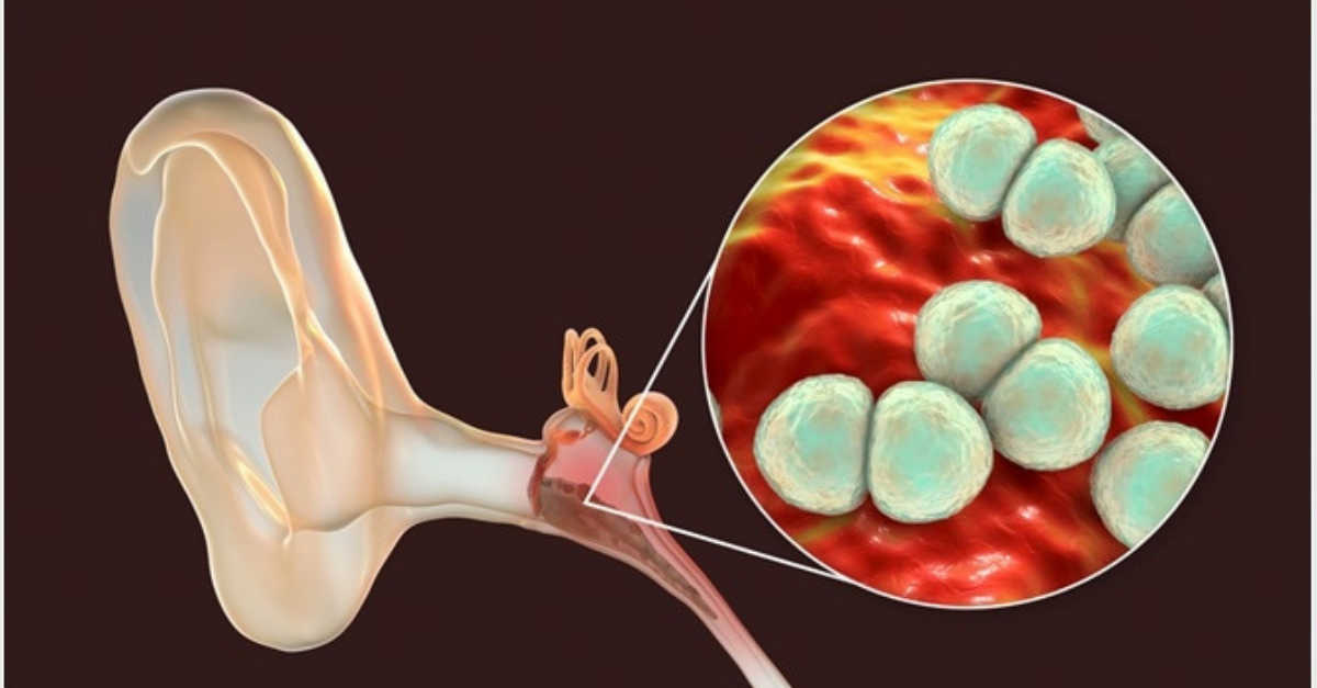 Otitis: un padecimiento más común de lo que parece