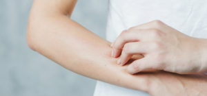 Alergia al sol: síntomas, causas y tratamientos