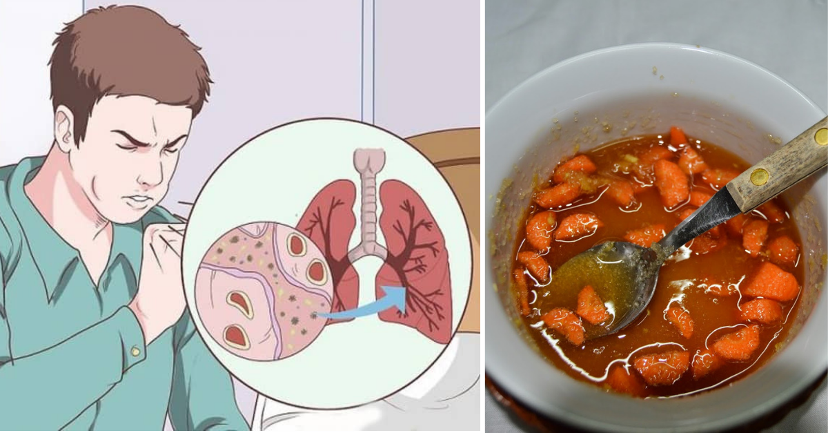 Cómo aliviar la tos: seca, con flema y alérgica