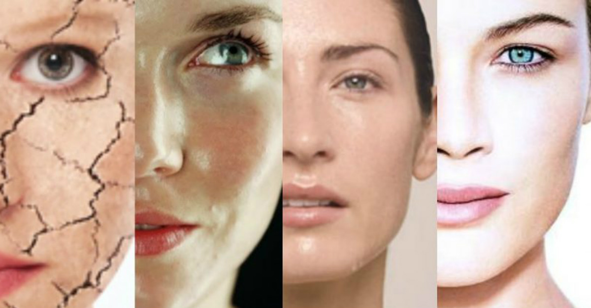 Tipos de piel y las características de cada una